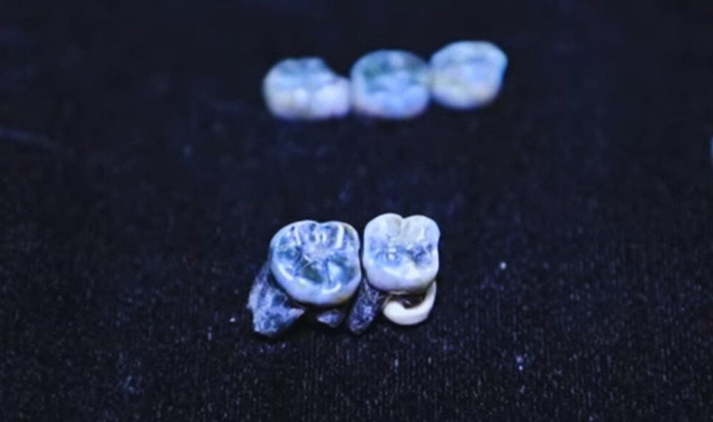 Anthropologists unearthed ancient teeth in Ethiopia that have just ...