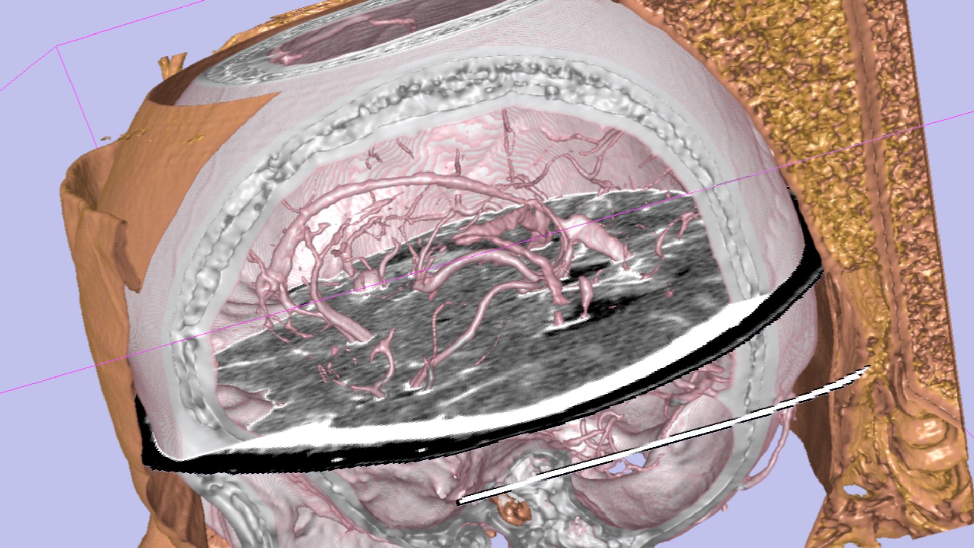 Scientists used CT scans to reveal the first accurate portrait of ...